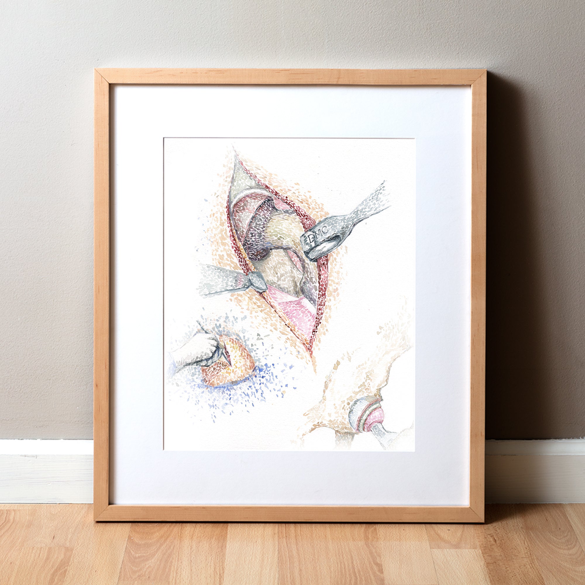 Custom Original Surgery Art – Lyon Road Art