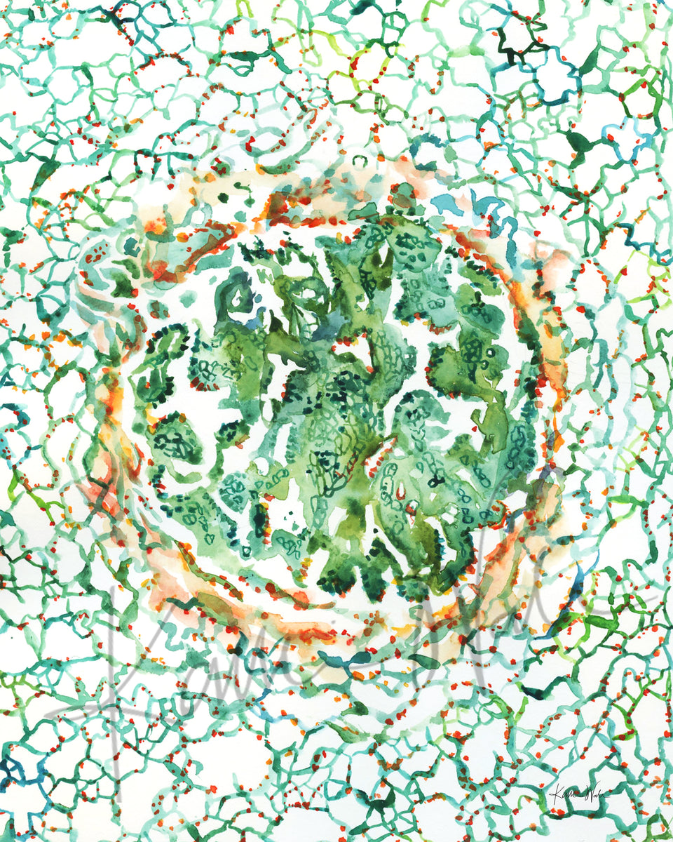 Adenocarcinoma Watercolor Print | Cancer Art | Medical Art – Lyon Road Art