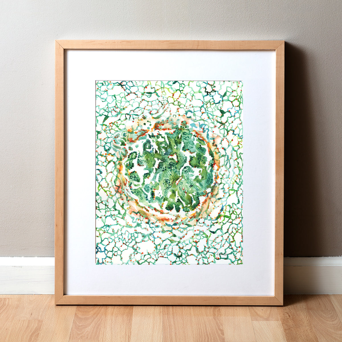 Adenocarcinoma Watercolor Print | Cancer Art | Medical Art – Lyon Road Art