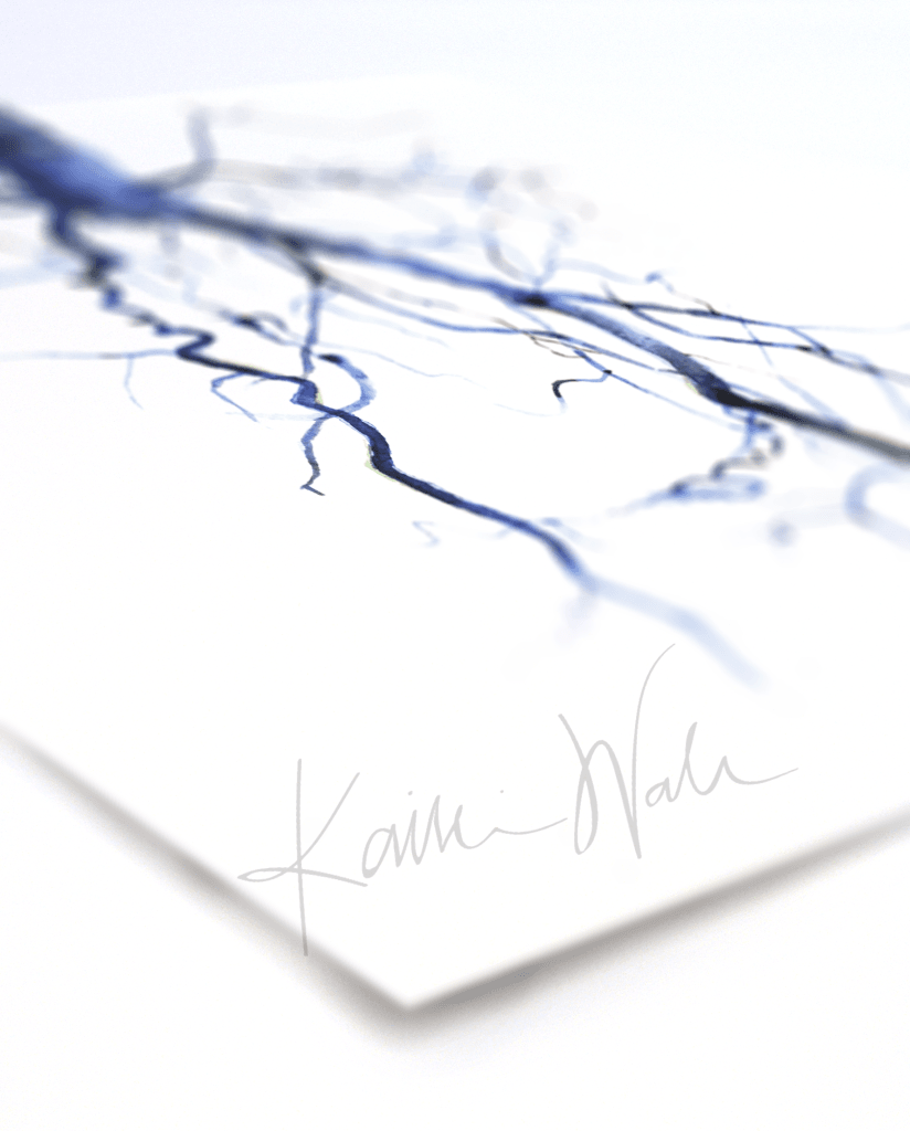 Aorta Angiogram Watercolor Print | Heart Art – Lyon Road Art