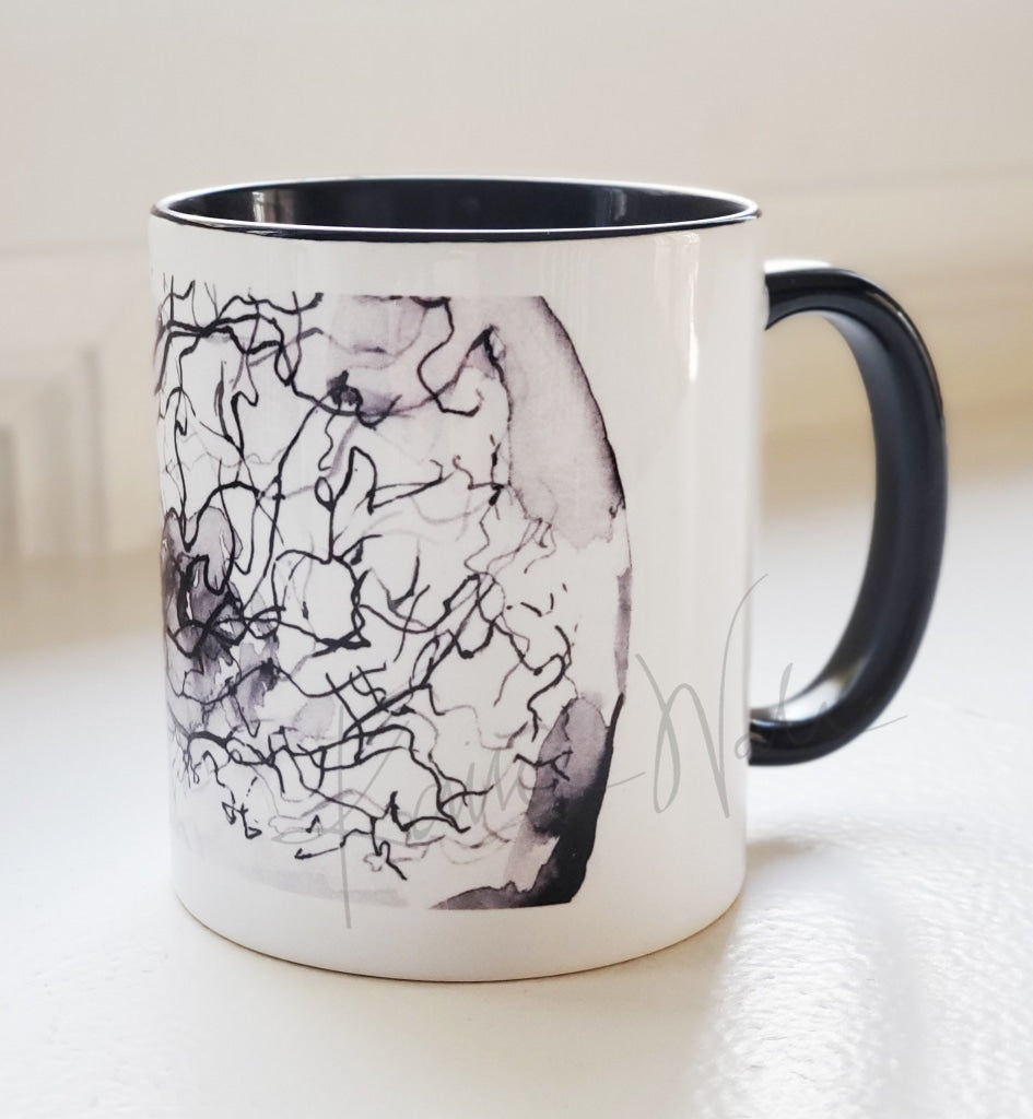 Cerebral Angiography Medical Art Mug – Lyon Road Art